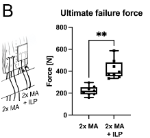 FiberLocker® System - ZuriMED Technologies AG